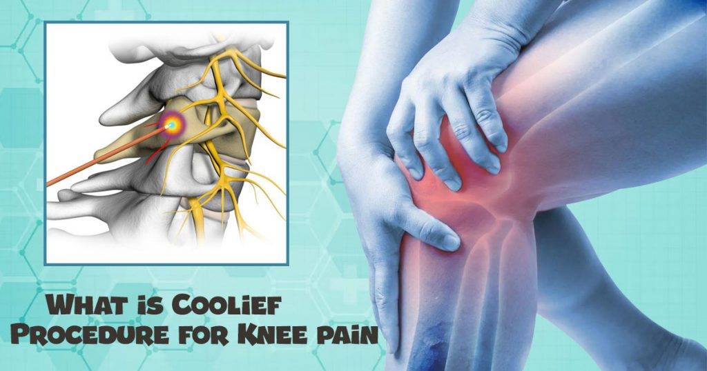 What is Coolief Procedure for Knee Pain?