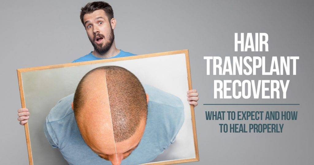 Hair Transplant Recovery: From Initial Healing to Full Results