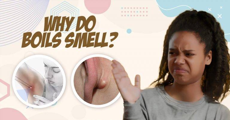 Why Do Boils Smell So Bad? Causes and Reasons for the Odor